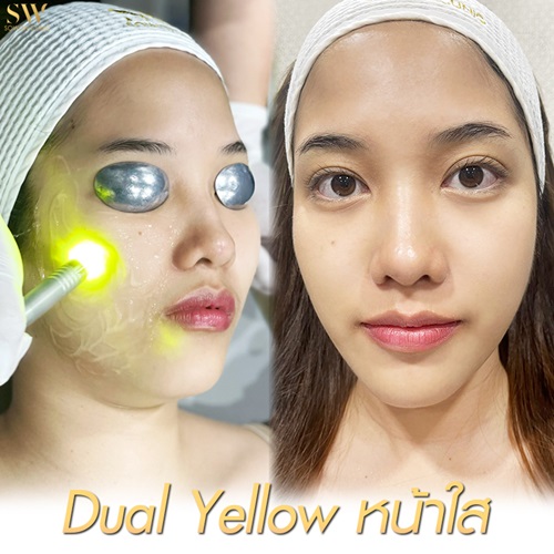 ed-1 (9) - Ladyissue เว็บรีวิวเครื่องสำอาง ชุมชนผู้หญิง ฮาวทูแต่งหน้า อัพเดทแบรนด์เนม เทรนด์ ...