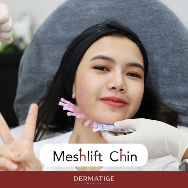 ed1 (7) - Ladyissue เว็บรีวิวเครื่องสำอาง ชุมชนผู้หญิง ฮาวทูแต่งหน้า อัพเดทแบรนด์เนม เทรนด์ ...