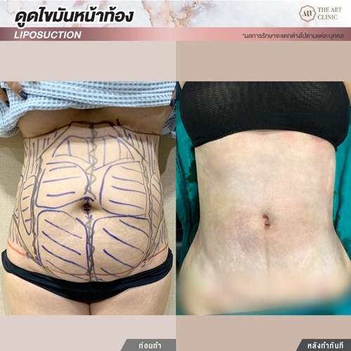 1 (2) - Ladyissue เว็บรีวิวเครื่องสำอาง ชุมชนผู้หญิง ฮาวทูแต่งหน้า อัพเดทแบรนด์เนม เทรนด์แฟชั่น ...