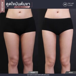 1 (5) - Ladyissue เว็บรีวิวเครื่องสำอาง ชุมชนผู้หญิง ฮาวทูแต่งหน้า อัพเดทแบรนด์เนม เทรนด์แฟชั่น ...