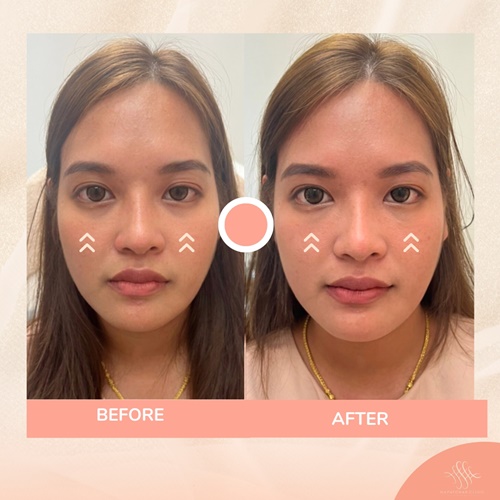 1 (2) - Ladyissue เว็บรีวิวเครื่องสำอาง ชุมชนผู้หญิง ฮาวทูแต่งหน้า อัพเดทแบรนด์เนม เทรนด์แฟชั่น ...