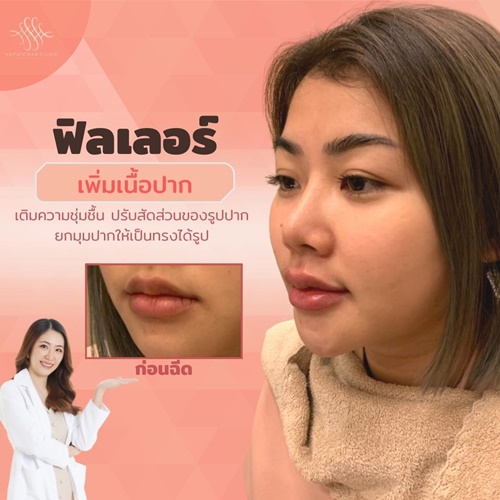 1 (7) - Ladyissue เว็บรีวิวเครื่องสำอาง ชุมชนผู้หญิง ฮาวทูแต่งหน้า อัพเดทแบรนด์เนม เทรนด์แฟชั่น ...